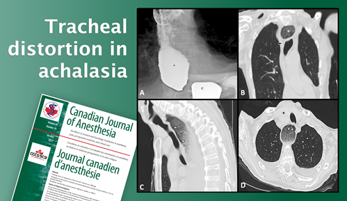 CJA Articles - What's Trending | Canadian Anesthesiologists' Society